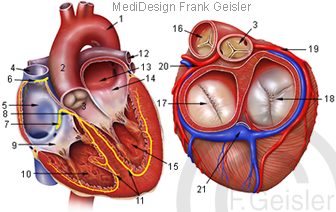 Koronare Herzkrankheit – Erkrankung der Herzkranzgefäße
