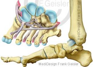 Spreizfuß, Fehlstellung am Fuß