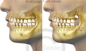 Zähne im Gebiss des Menschen