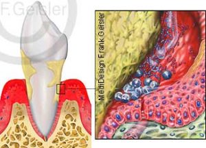 Gebiss, Zähne und Zahnformel